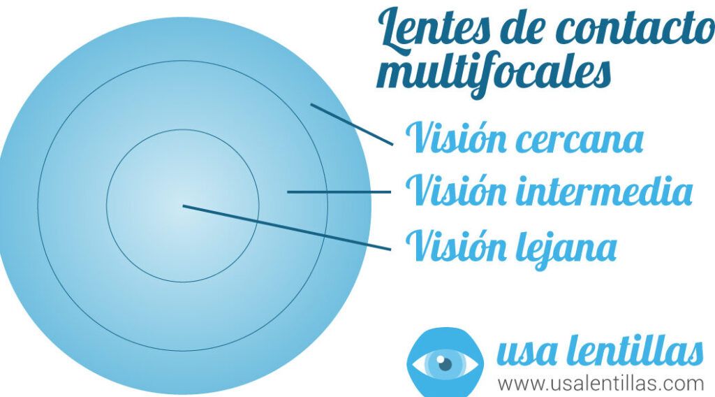 Adaptación de lentes de contacto multifocales vs. convencionales