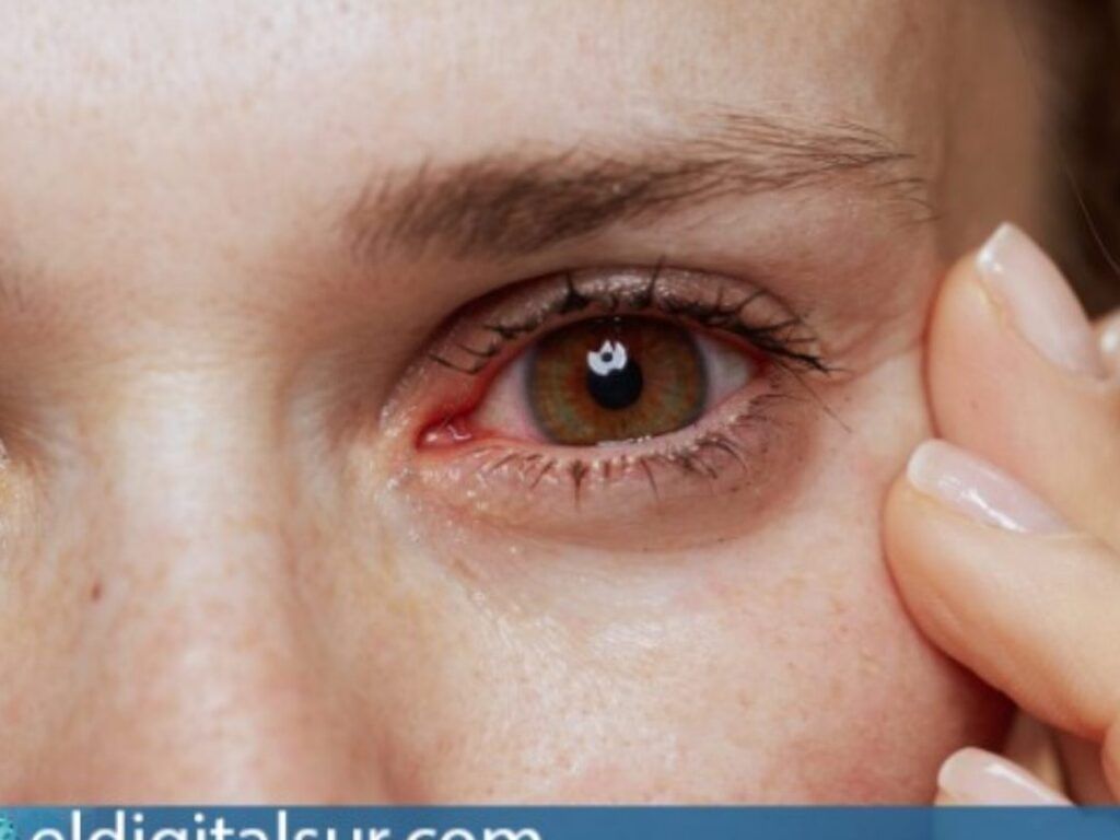 Por qué se hinchan los ojos al llorar: 10 causas y soluciones